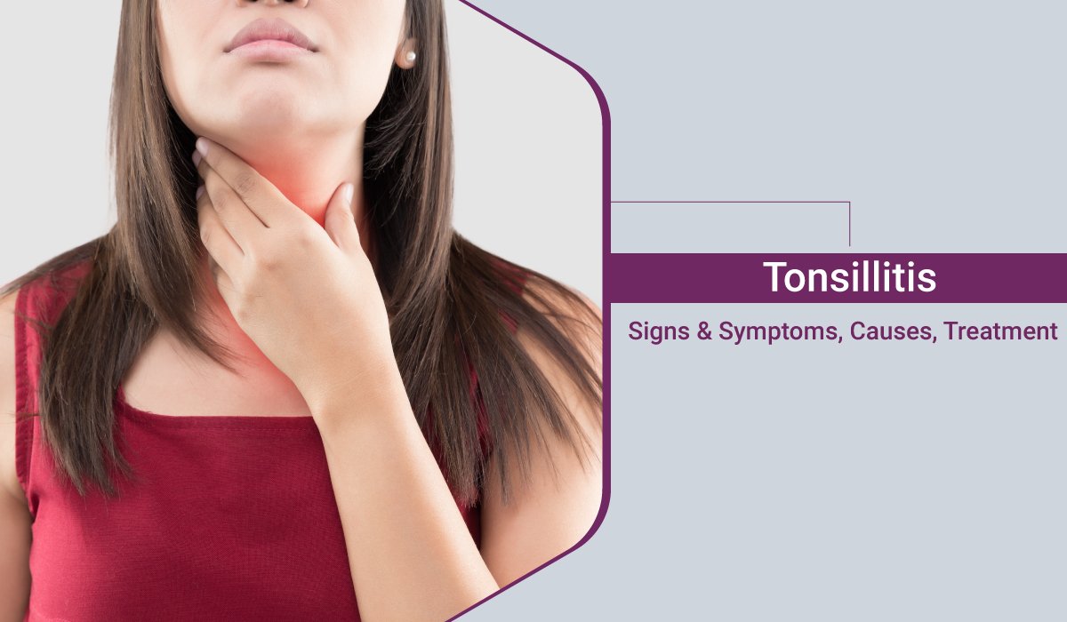 Tonsillitis: Signs and Symptoms, Causes, Treatment