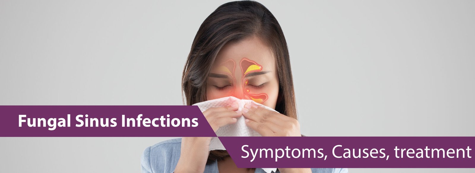 Fungal Sinus Infections: Symptoms, Causes, Treatment