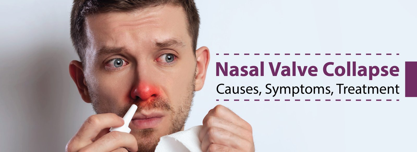 Nasal Valve Collapse: Causes, Symptoms, and Treatment