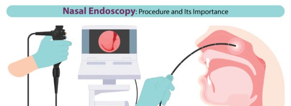 Nasal Endoscopy Procedure and Importance | Ace ENT Clinic