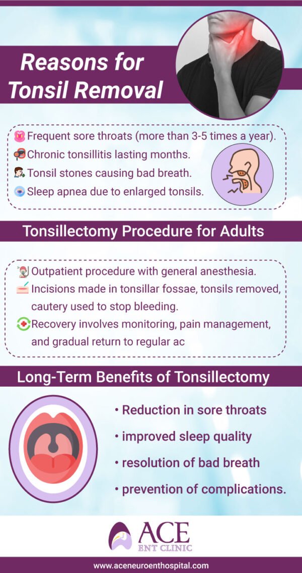 When Is Tonsil Surgery Necessary? Exploring Adult Tonsillectomy
