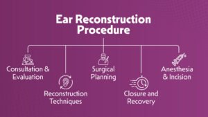 Ear Reconstruction Surgery: Types, Procedure, and Care