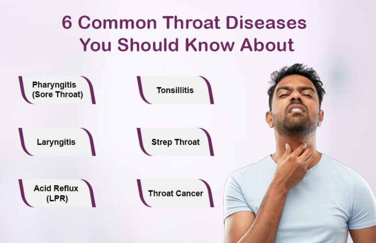 What are the Common Diseases of the Throat? - Dr Simple Bhadania