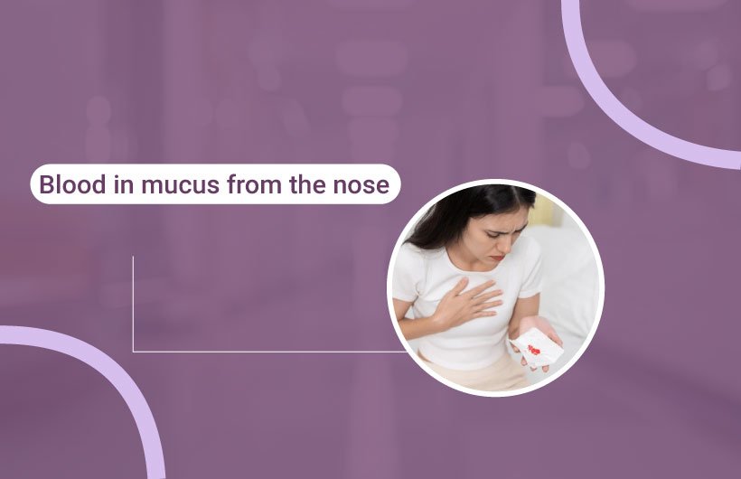 Blood in Mucus from Nose – Causes, Treatment - Dr Simple Bhadania